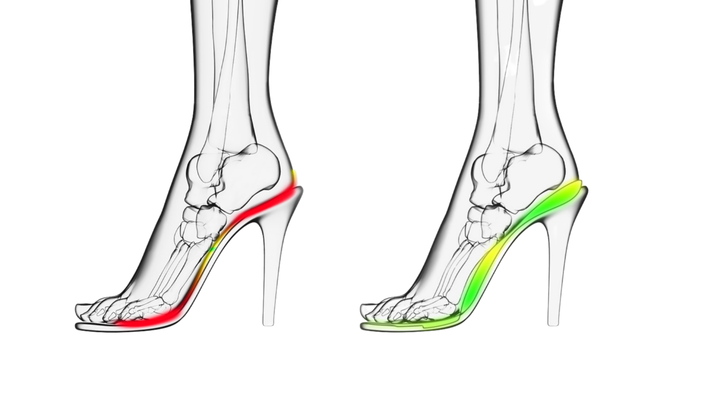 Orthopedic pumps - Stinaa.J